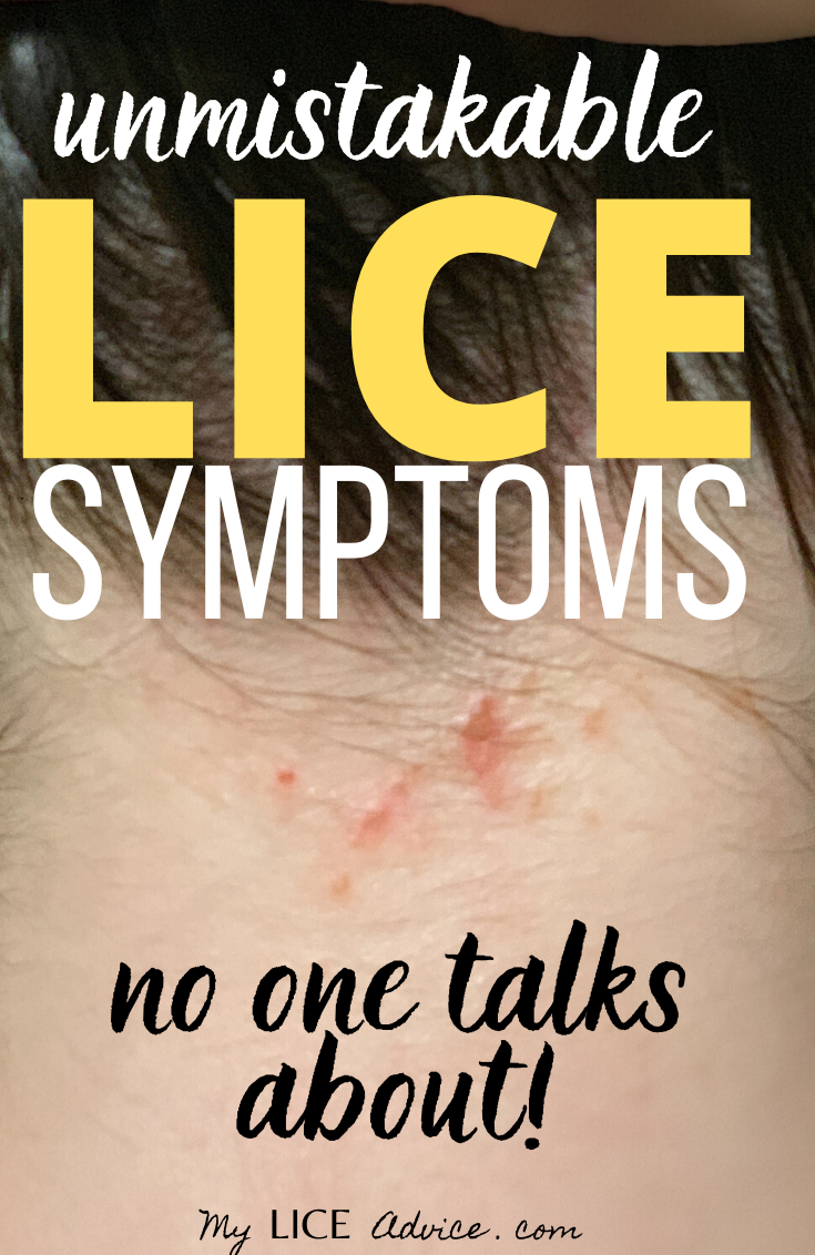 Identify My Lice Advice