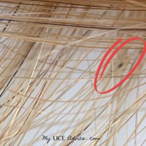 A Closer Look at Lice Bites and Rashes with Pictures - My Lice Advice