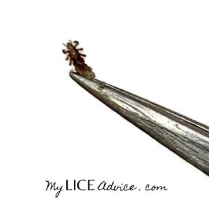 What Lice Look Like: Pictures of Lice (Color, Size, and More)