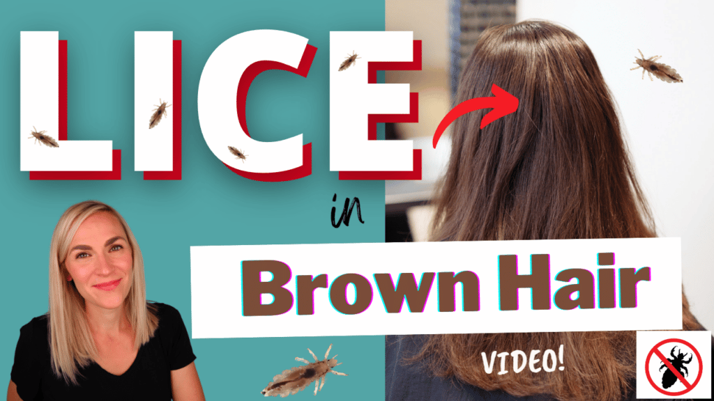 My Lice Advice Videos and Tutorials - My Lice Advice